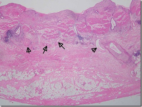 Medicine Decoded: Medical pearls{high yield facts}